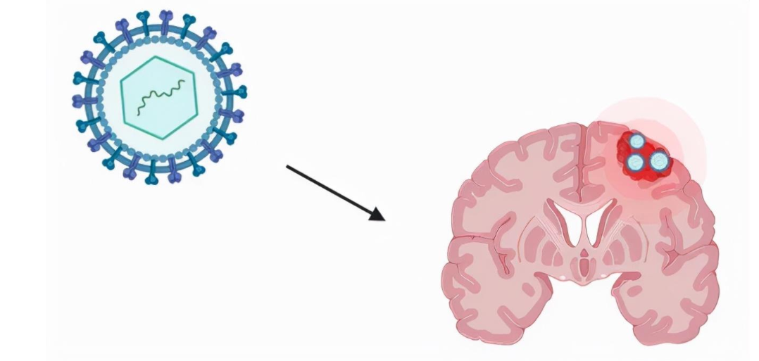 【8万一针】日本溶瘤病毒疗法Delytact上市，2023年可赴日接受治疗 - 传祺国际健康