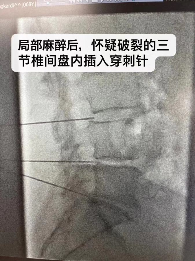 【NEWS】DST治疗患者可办理医疗签证赴日了 - 传祺国际健康